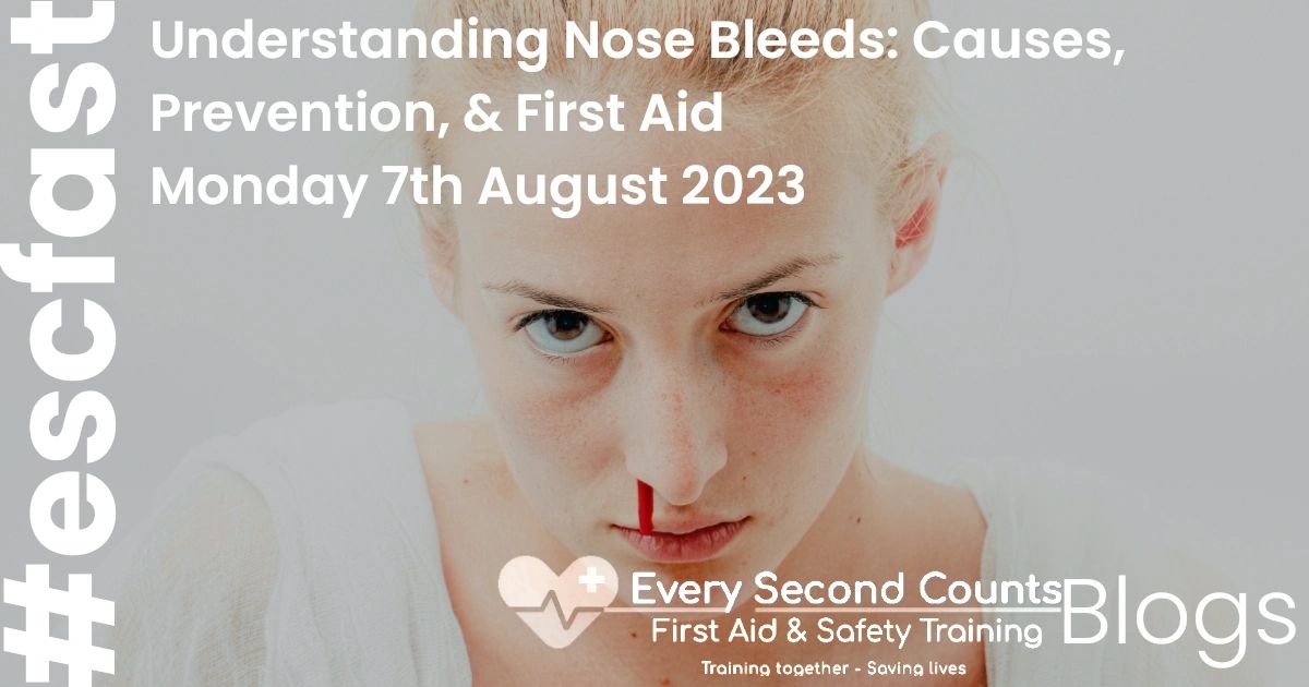 Understanding Nose Bleeds: Causes, Prevention, & First Aid