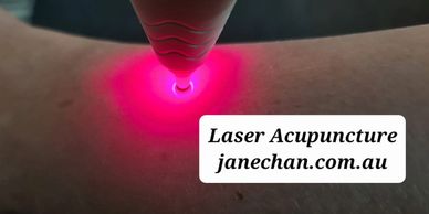 Laser Acupuncture | Acupuncture and Chinese Herbal Medicine at Healthy ...