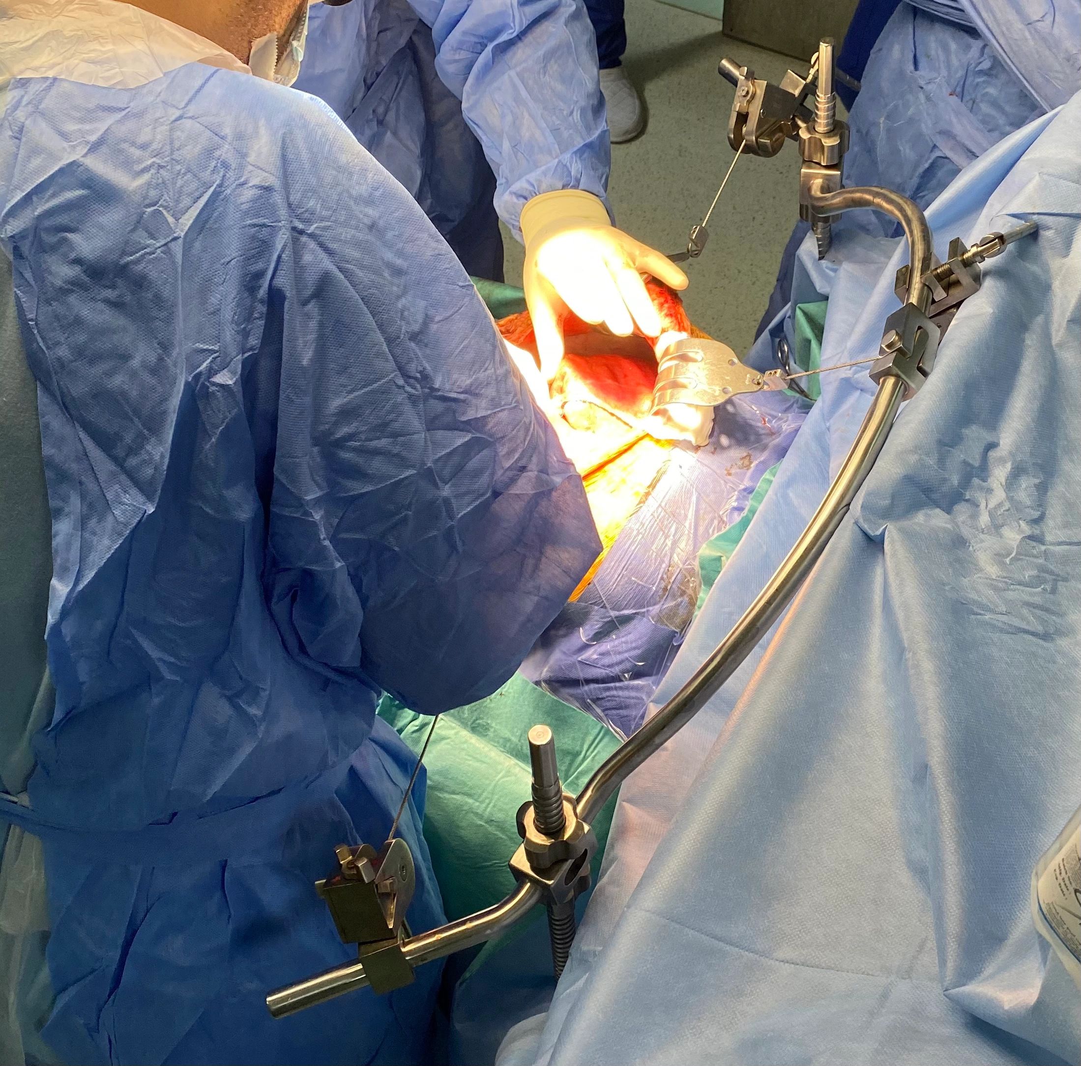 The Onetrac table mounted surgical retractor