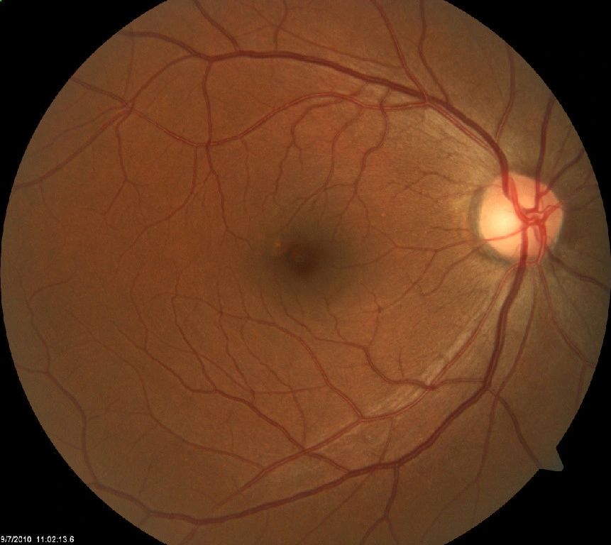 Southern California Retina Center