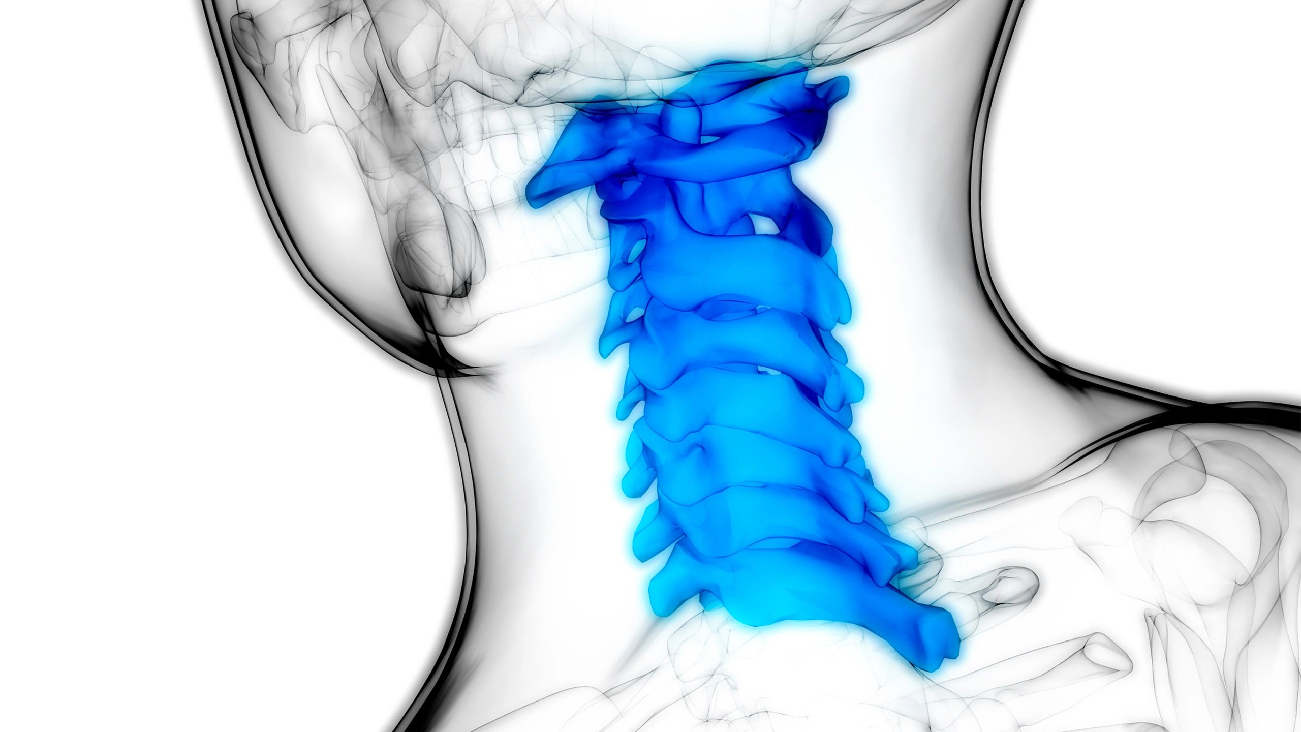NIHR POLYFIX-DCM Trial
