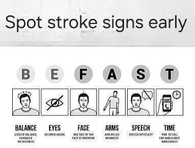Recognizing the Signs of StrokeA Crucial Guide to Early Detection
