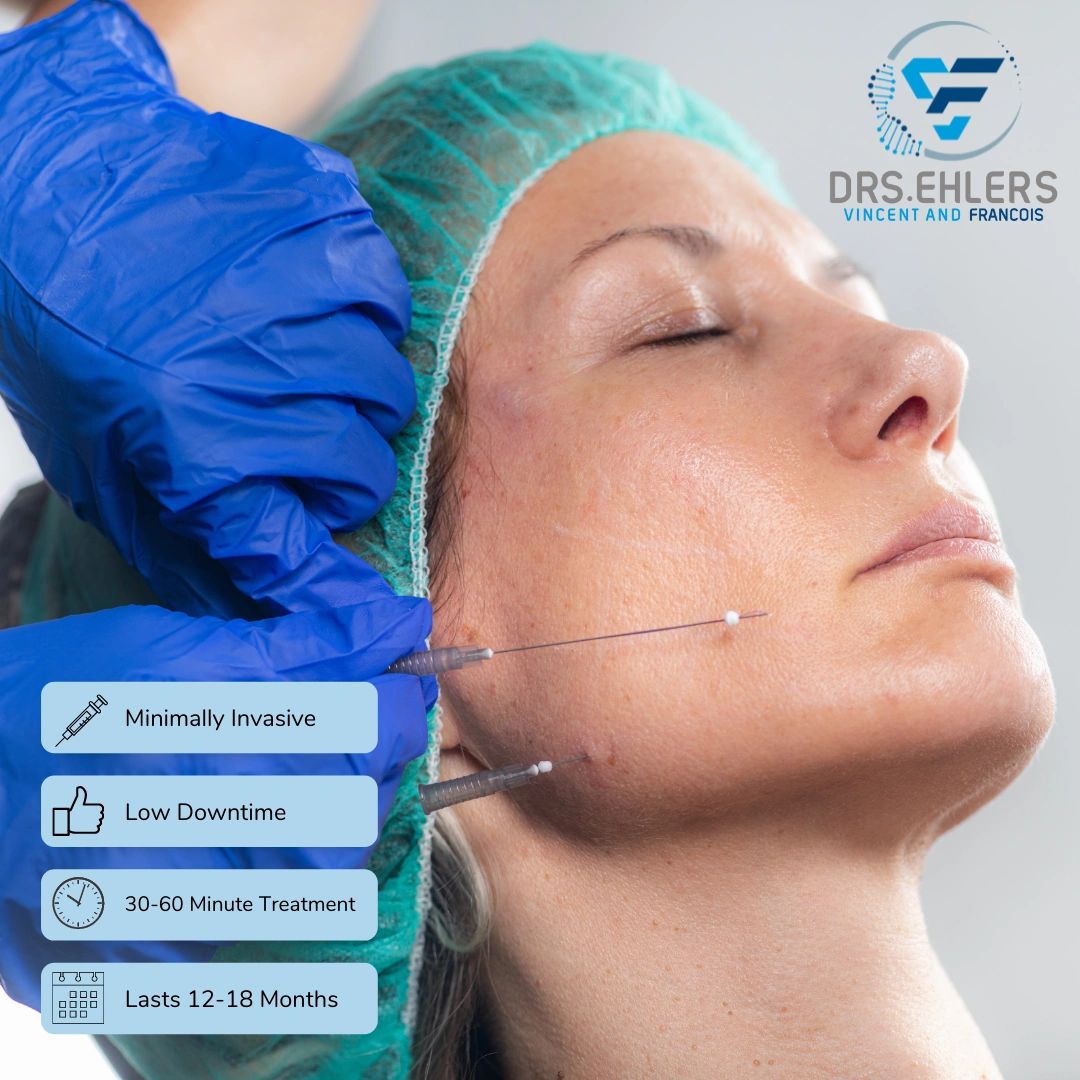 What Is Thread Lifting?