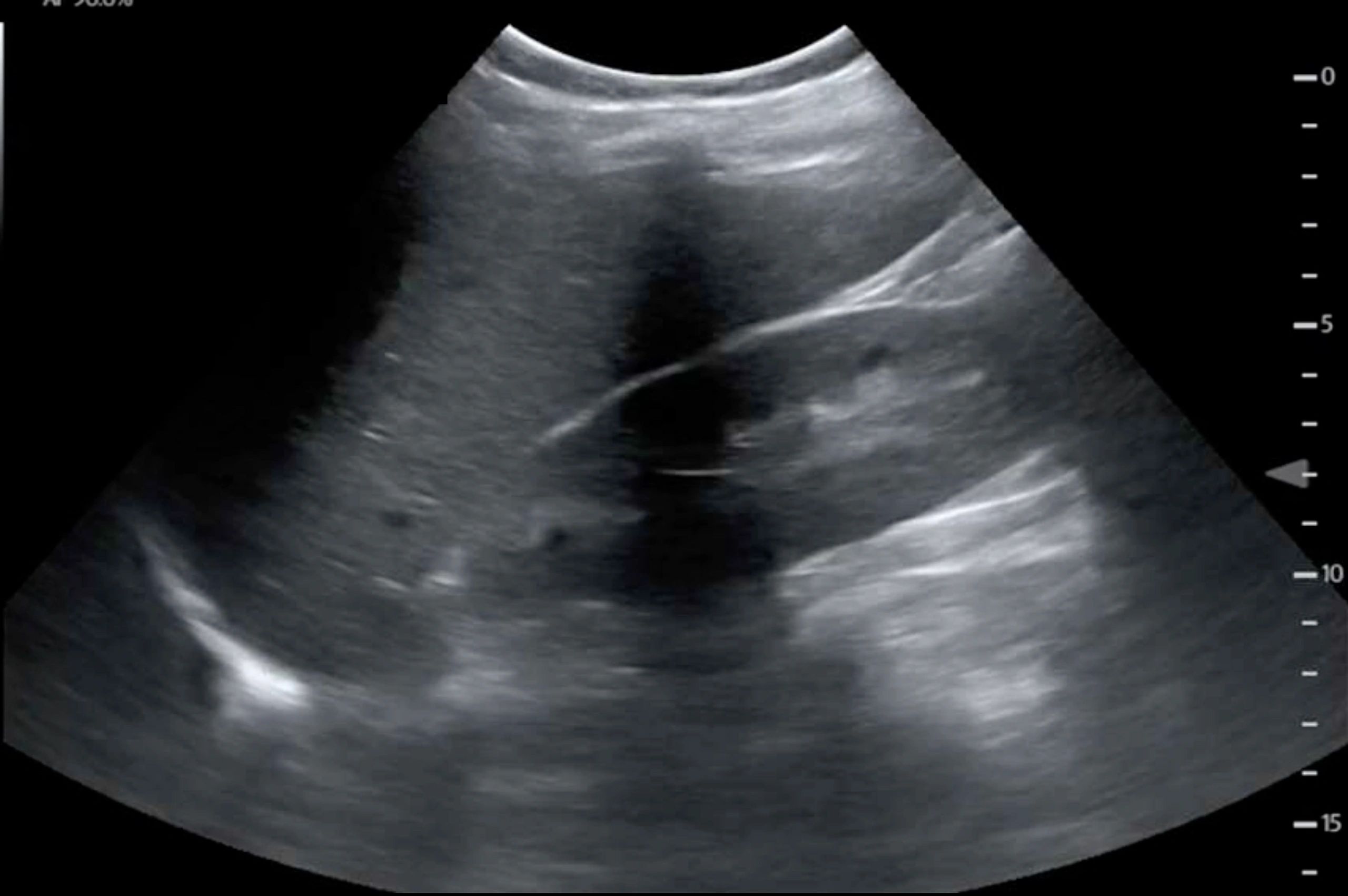 Point-of-Care Ultrasound Consulting Services | Peachtree POCUS