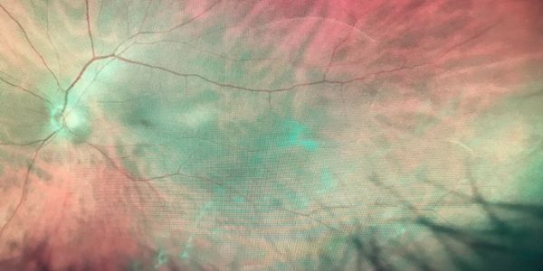 Barrington Eye Center