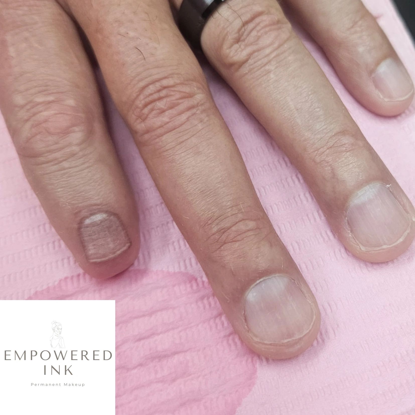 What Is a Paramedical Tattoo? Understanding This Restorative Art