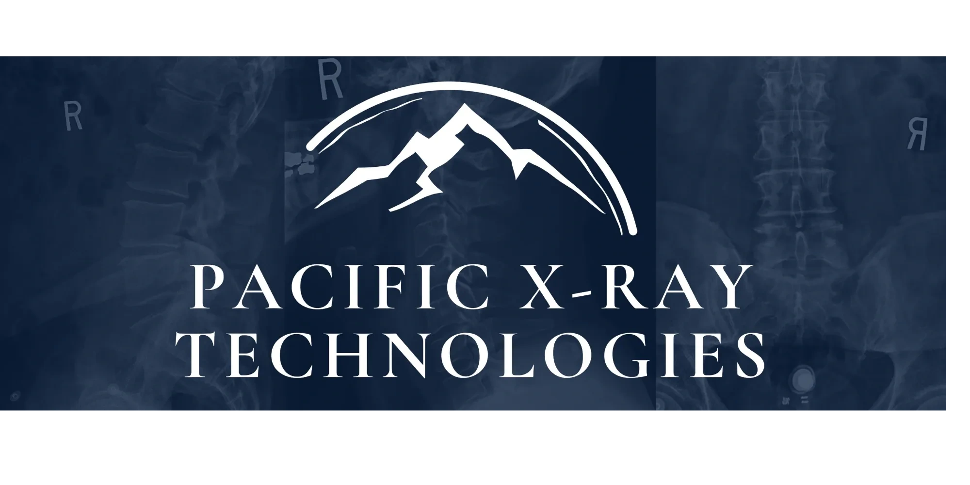 Pacific X-ray Technologies - Digital X-Ray, X-Ray