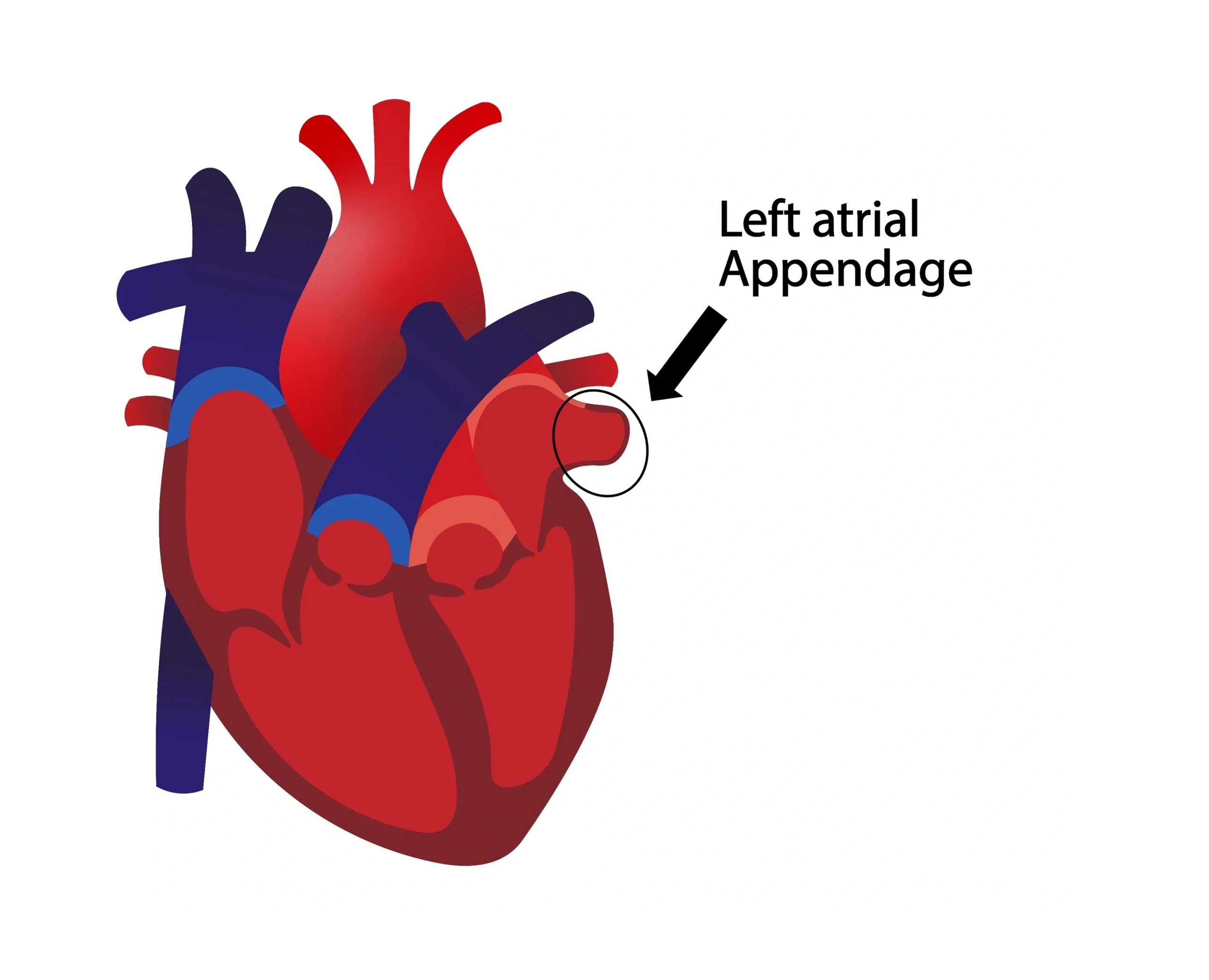 The atrial appendage as a cell source for cardiac cell therapy