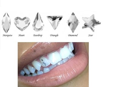 Sorriso Dental Care - Tooth Jewellery, Tooth Crystals, Tooth Gems ...