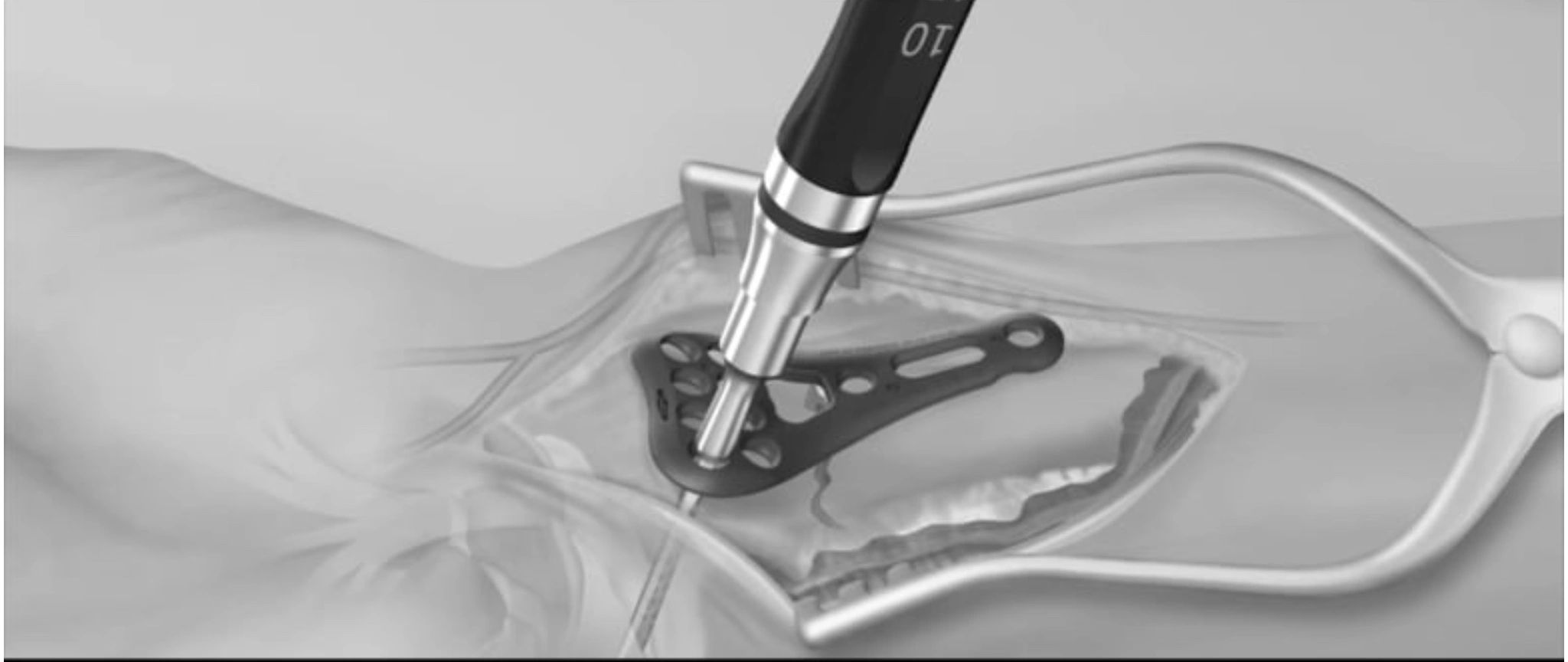 Alpha Spine and Orthopedic Technologies