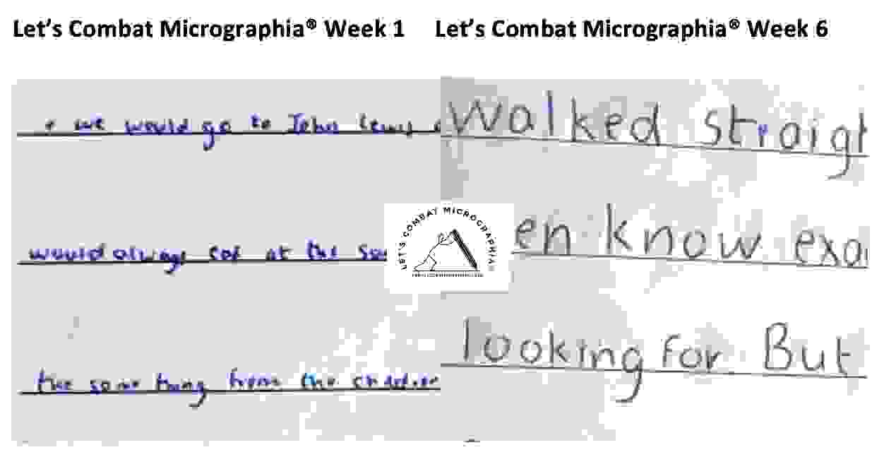 Let's Combat Micrographia - Micrographia, Parkinson's Disease