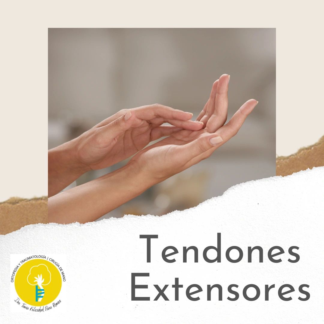 ¿Sabes qué es un Tendón Extensor?
