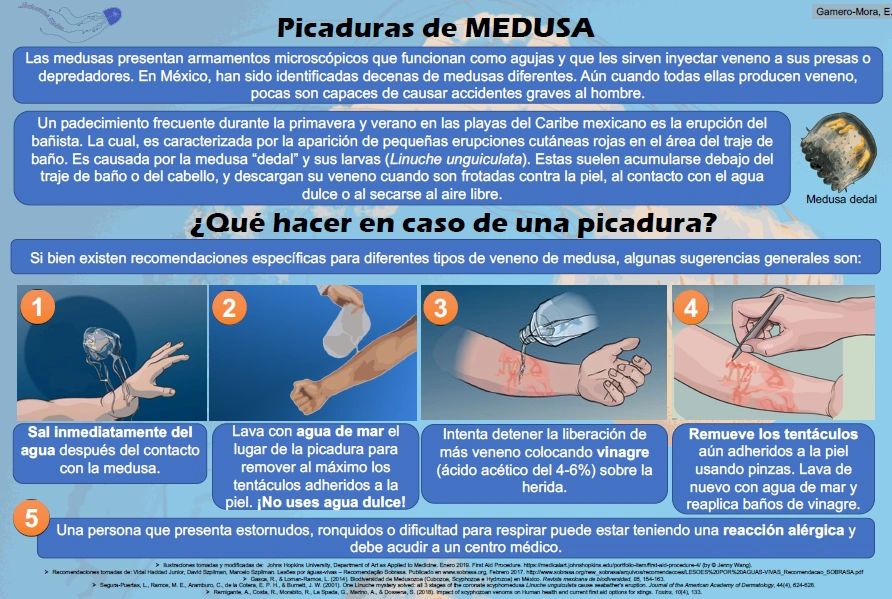 Picaduras De Medusa