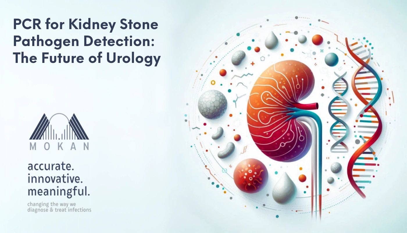 PCR for Kidney Stone Pathogen Detection: The Future of Urology