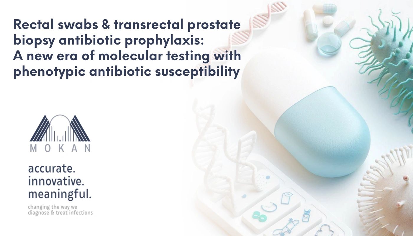 Rectal Swabs & Targeted Antibiotics Before Prostate Biopsy