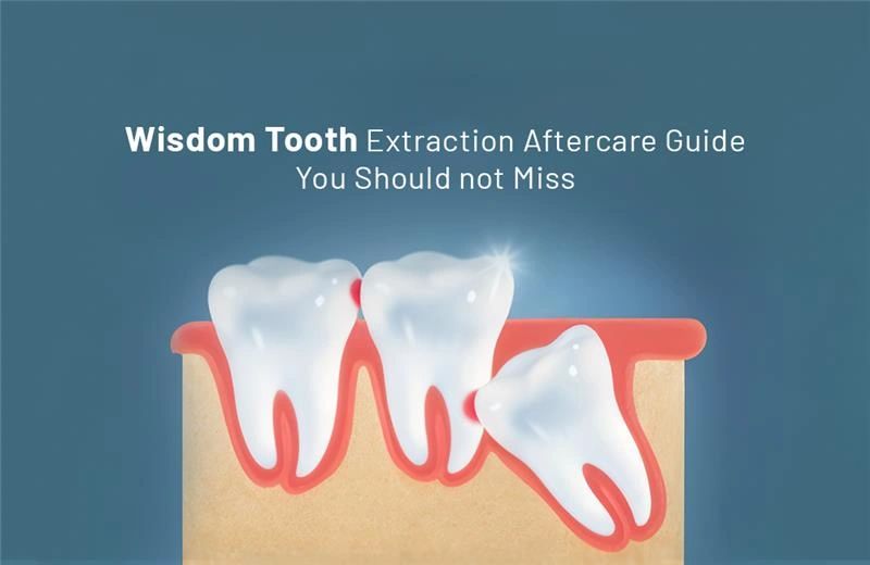 Wisdom Tooth Extraction Aftercare Guide You Should not Miss