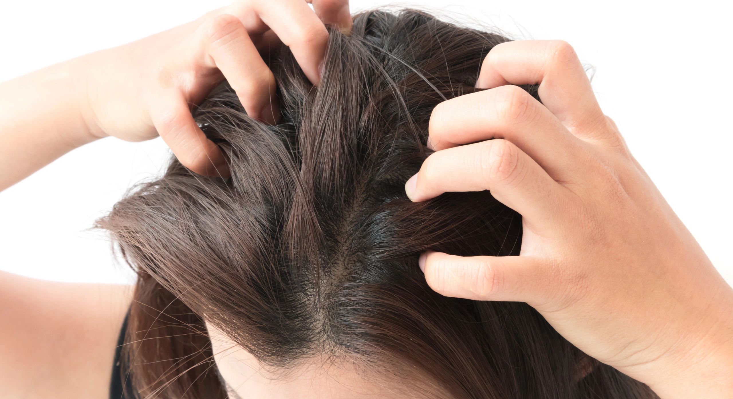 10 Reasons Why Your Scalp Itches