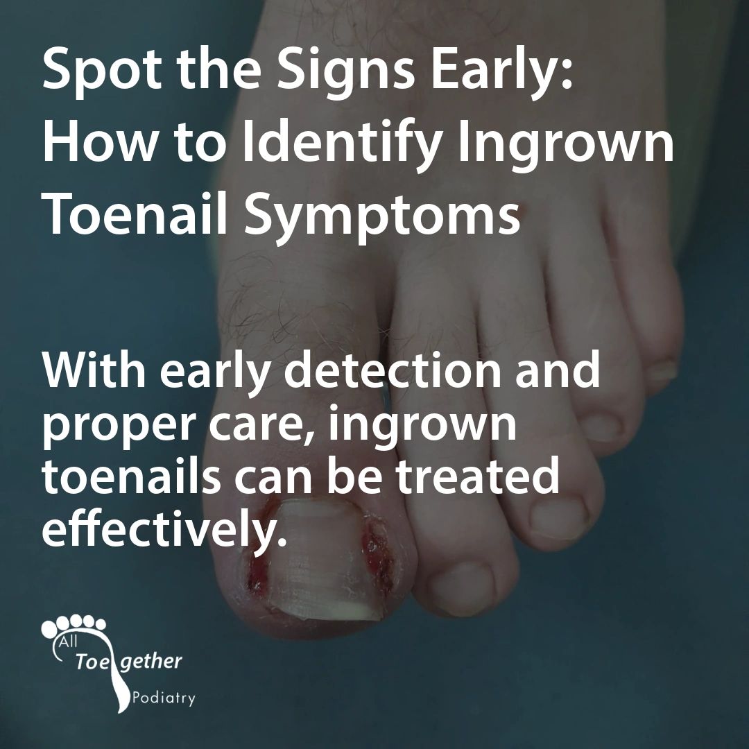 Spot the Signs Early: How to Identify Ingrown Toenail Symptoms