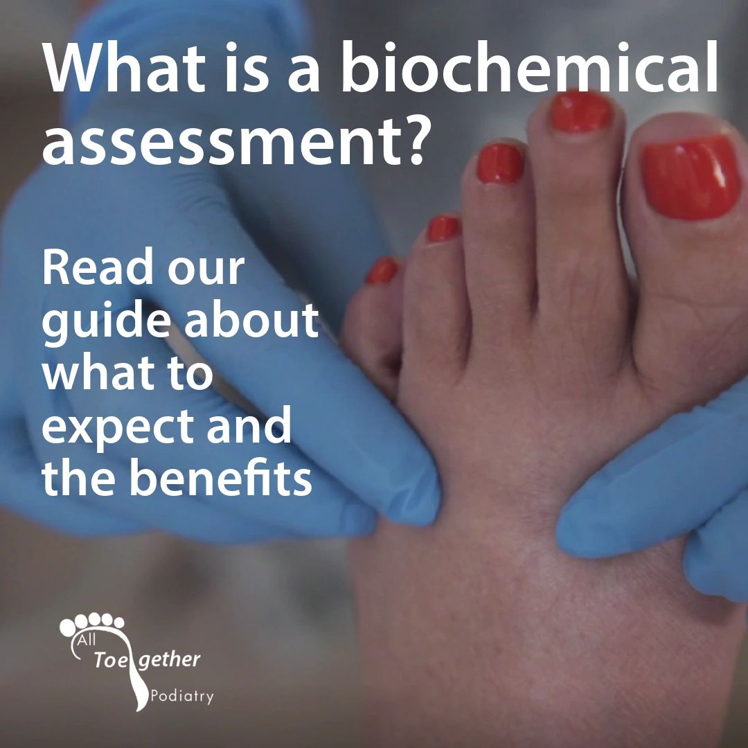 What is a Biomechanical Foot Assessment?