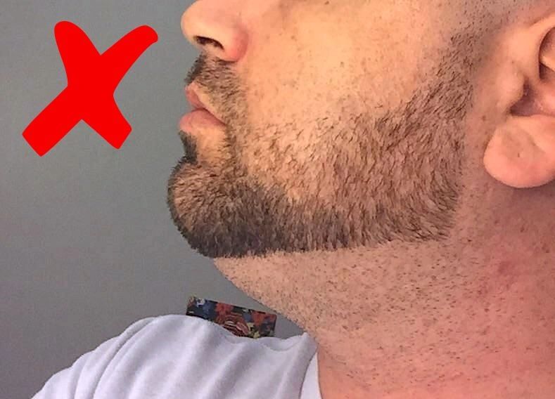 So I Screwed Up My Beard: A Hairy Tale of Grooming Misadventures