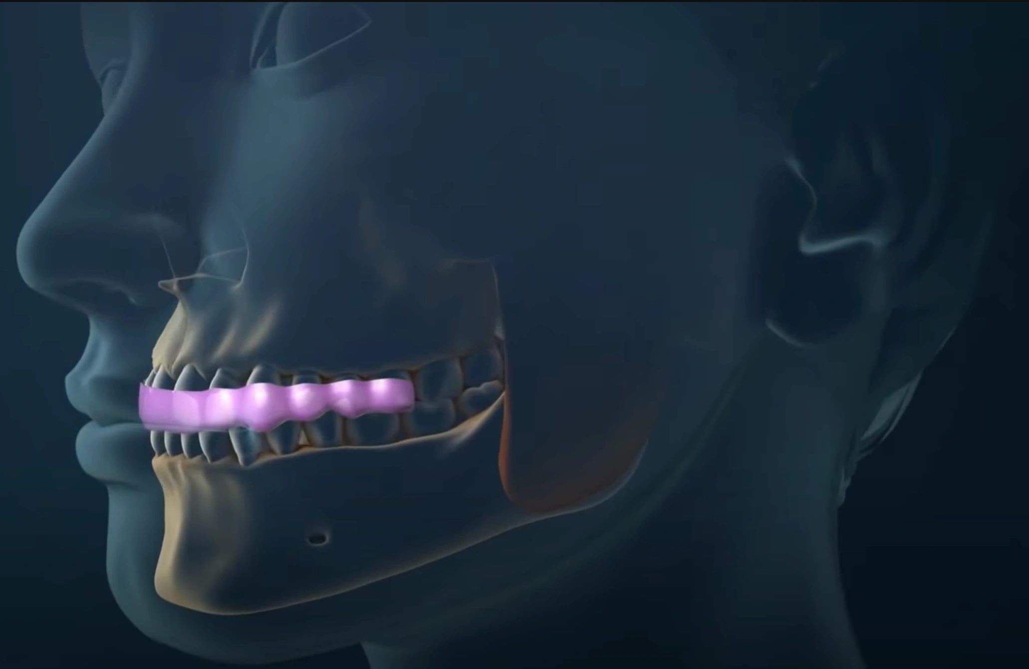 Understanding TMJ Issues and Effective Cures