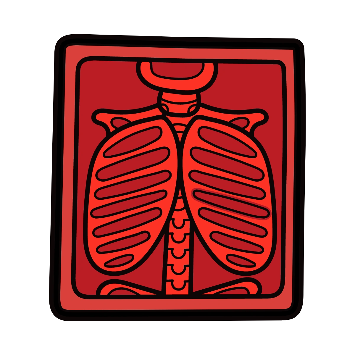 Chest X-Ray Analysis System