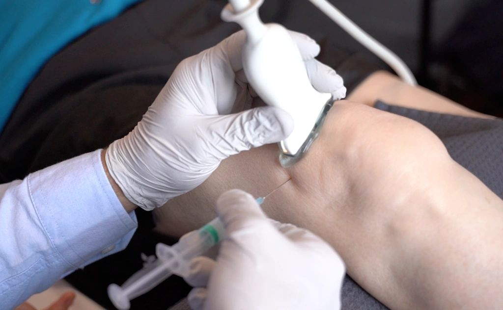 What is hyaluronic acid injection to the knee?