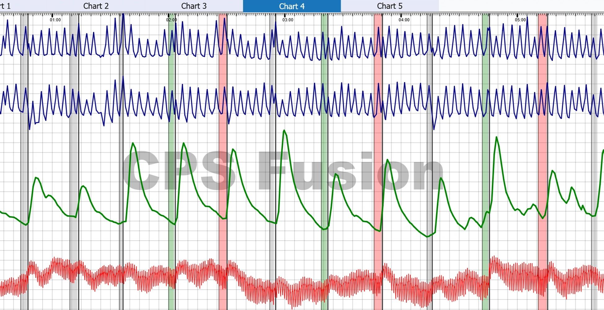 Marston Polygraph Academy - Polygraph School, Lie Detector, Polygraph