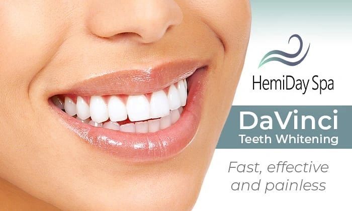 Exclusive Teeth Whitening Offers in Miami