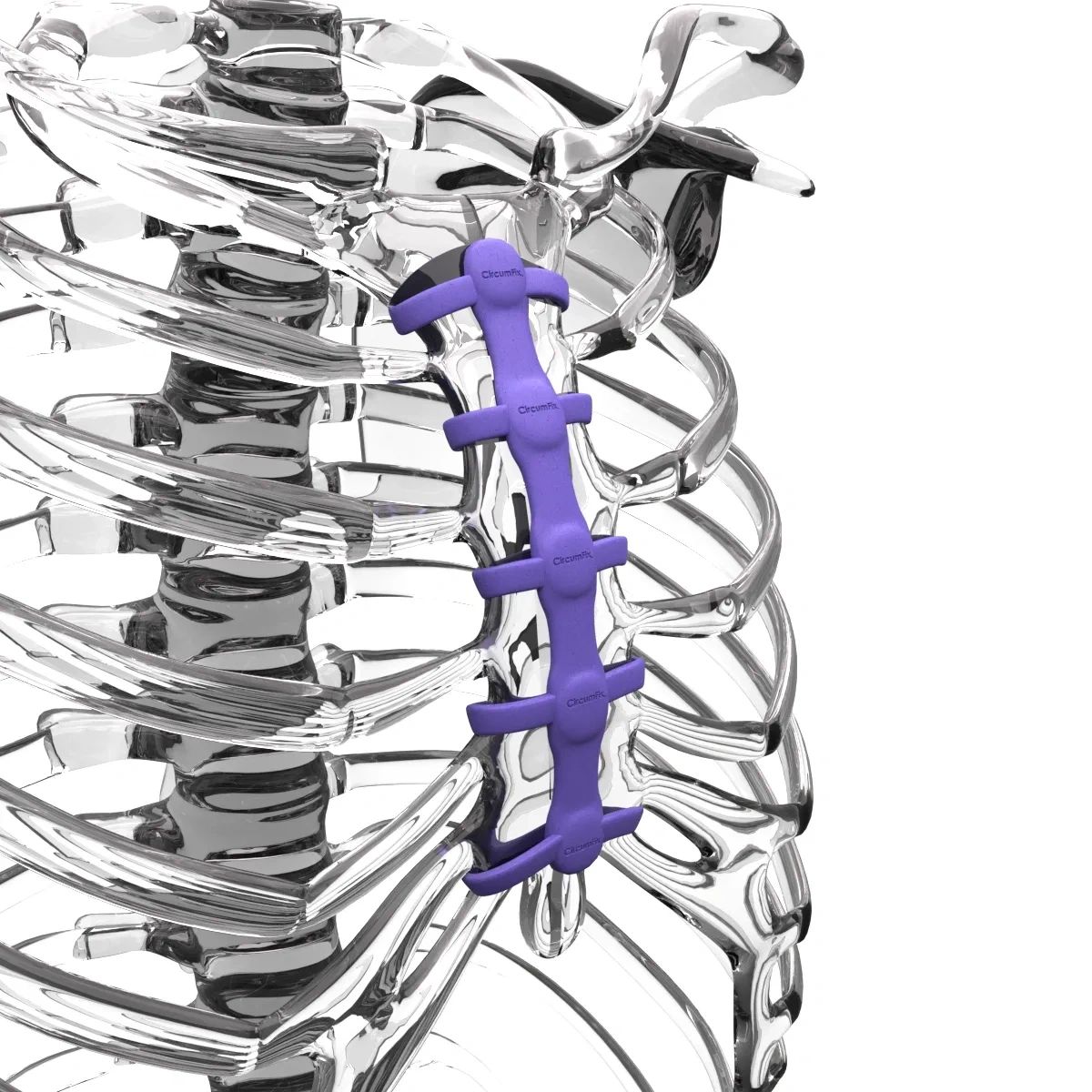 CircumFix Solutions, Inc