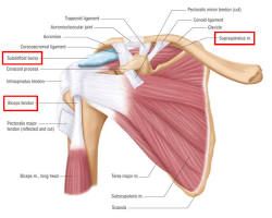 Dry Needling for Shoulder Pain and Increased Range of Motion