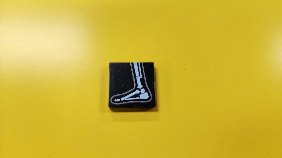 2x2 Printed Tile Foot Xray