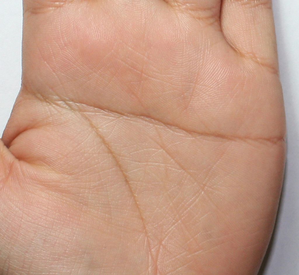 Simian Crease Famous People