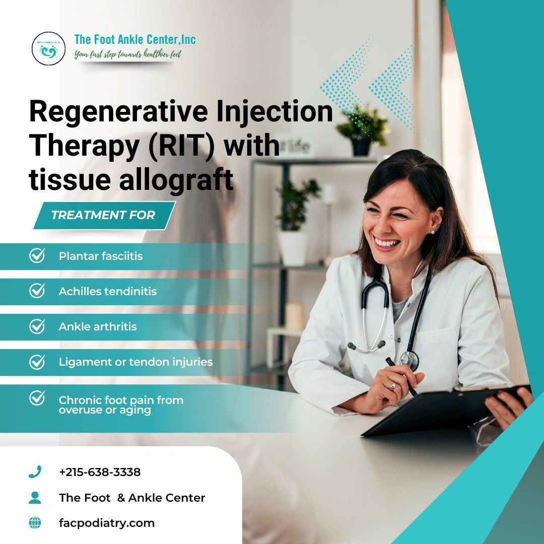 Regenerative Injection Therapy with Tissue Allograft
