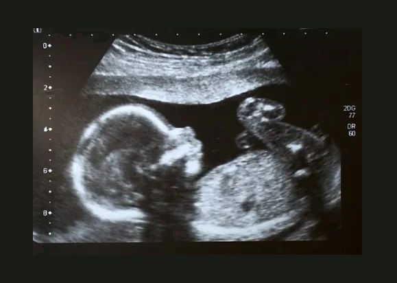 2D BABY SNEAK PEEK