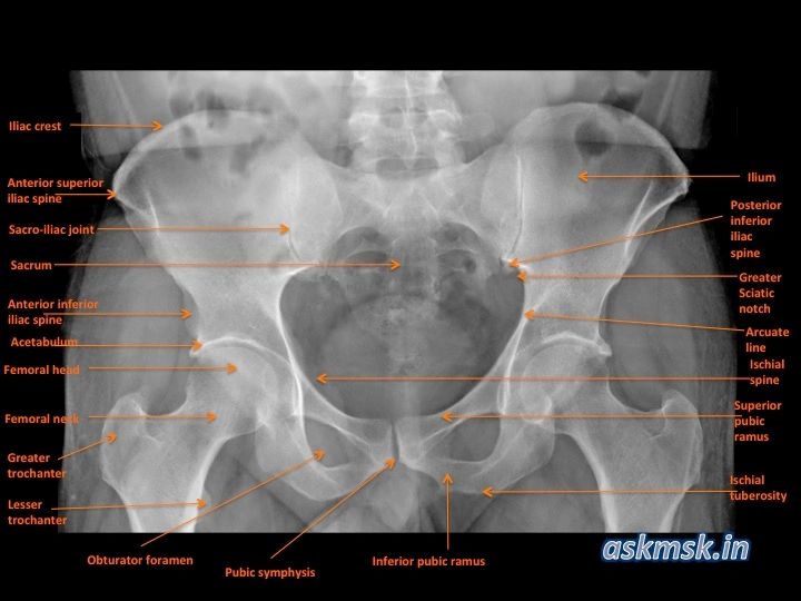 Pelvis Anatomy Xray