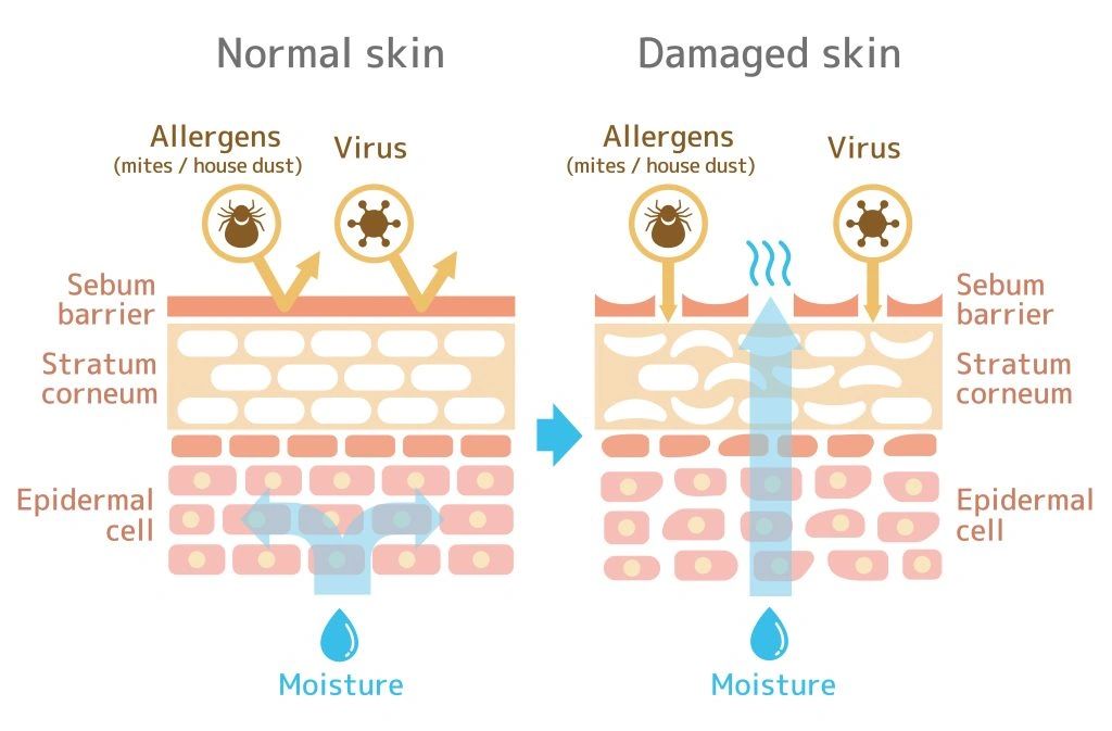 The Importance of Skin Barrier Protection: How to Keep Your Skin