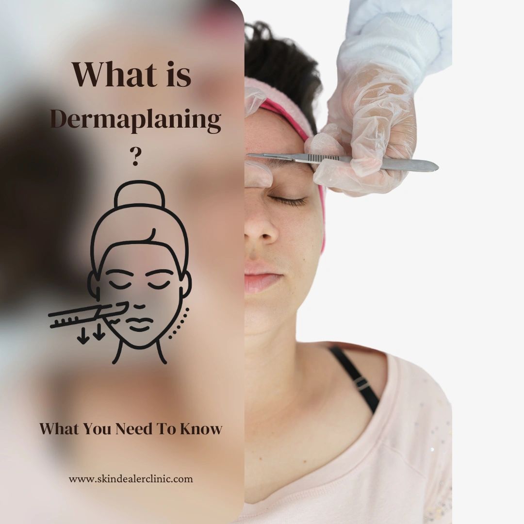 What Is Dermaplaning? Here’s What It Really Is