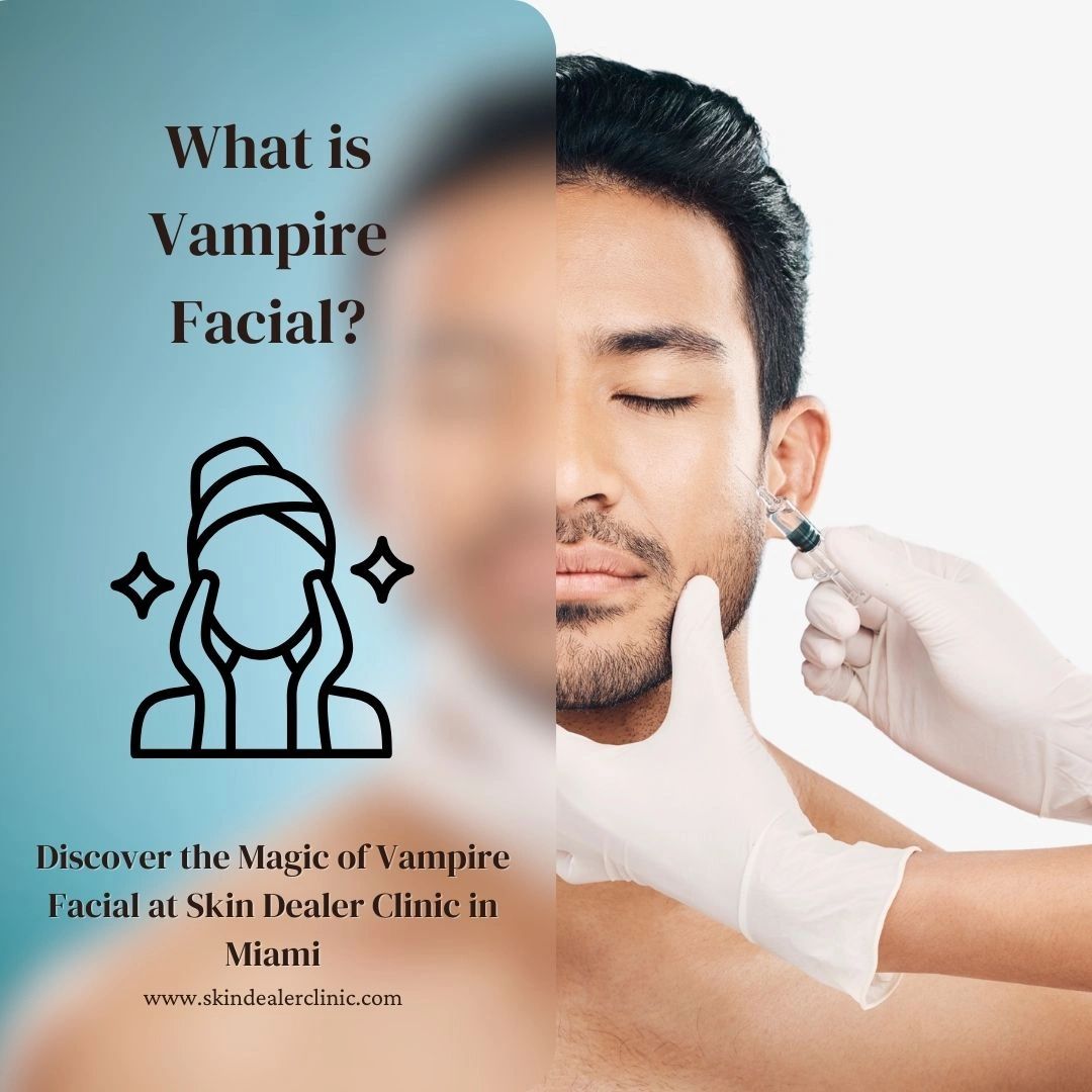 What is Vampire Facial (PRP)?