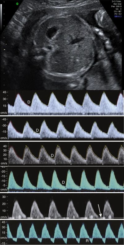 Scans | Chennai Fetal Care