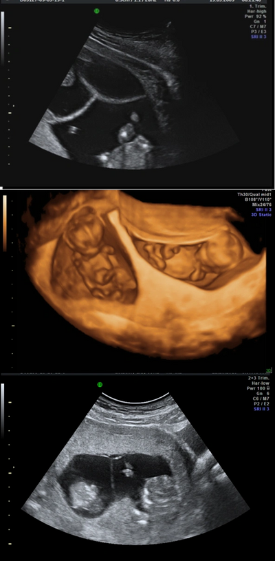 Scans | Chennai Fetal Care