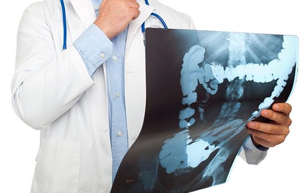 ¿Que trata un coloproctólogo o proctólogo?