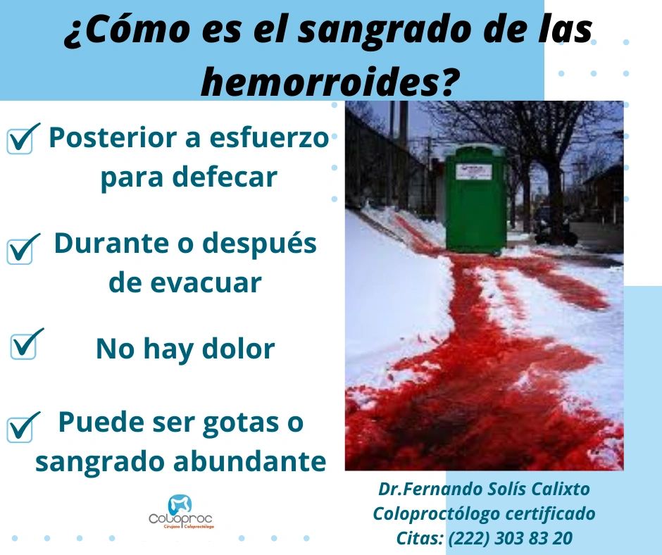 ¿Cómo es el sangrado hemorroidal?