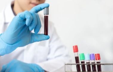 Functional Blood Chemistry Analysis (FBCA) Panel