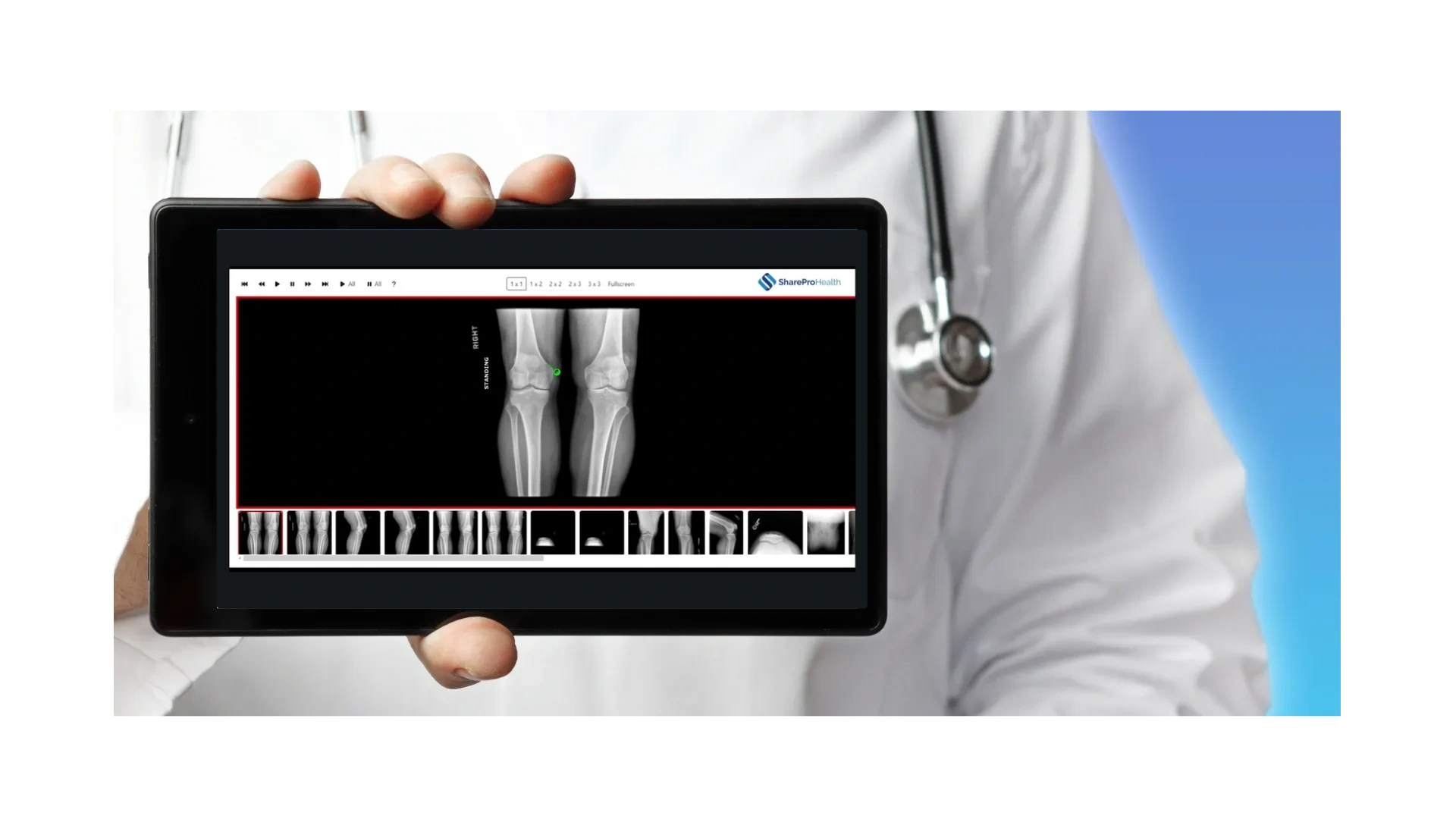 Revolutionizing Radiology Film Delivery: The Power of IMOD