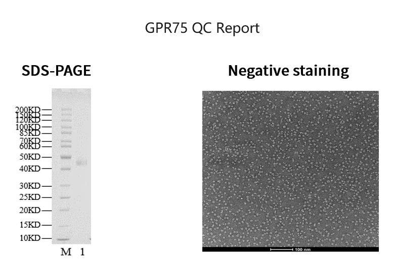 GPR75: a new target for the treatment of obesity and fatty liver