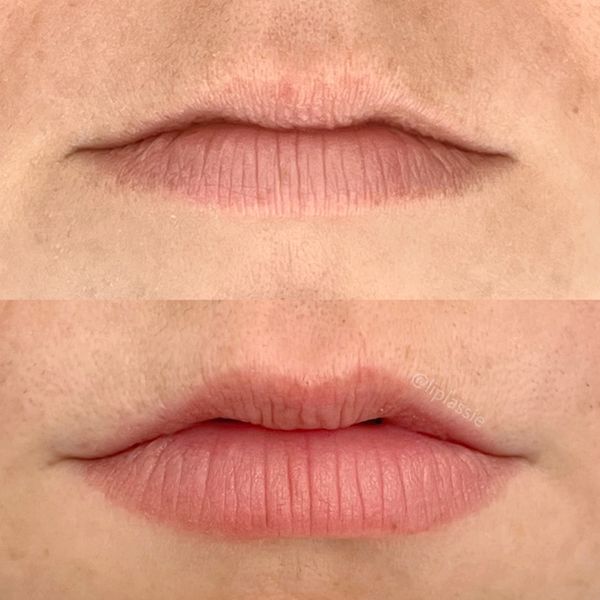 LIP LASSIE - Lip Blush Toronto