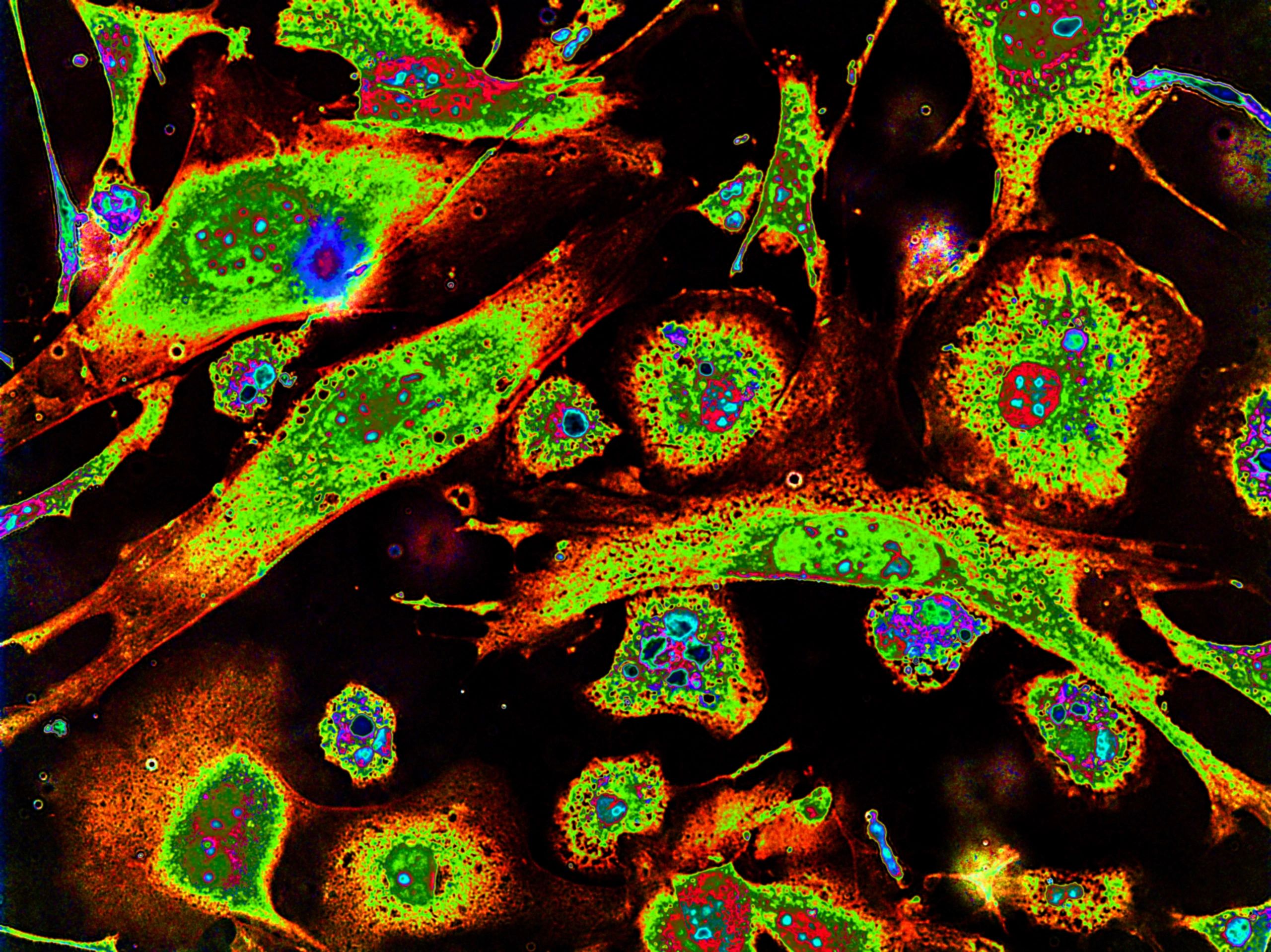 The Wrong Cells: Cross Contamination in Cell Culture