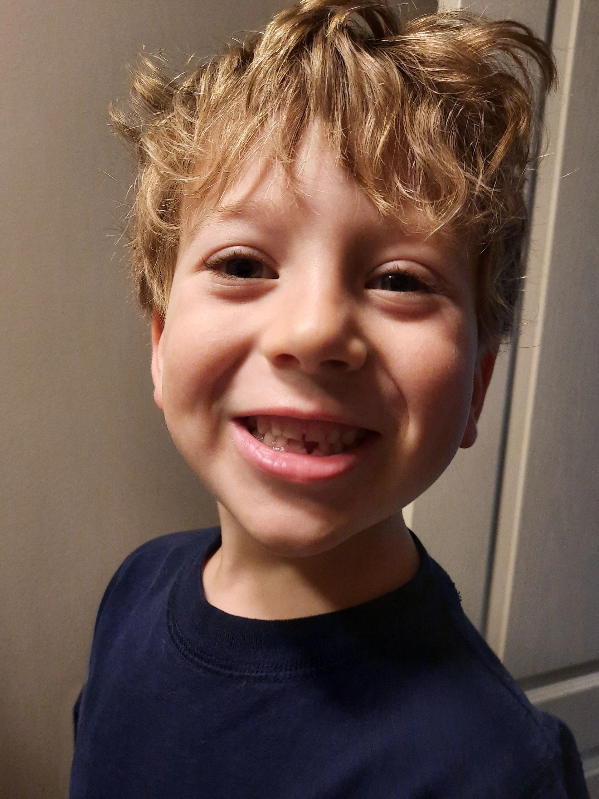 Lost his second tooth!