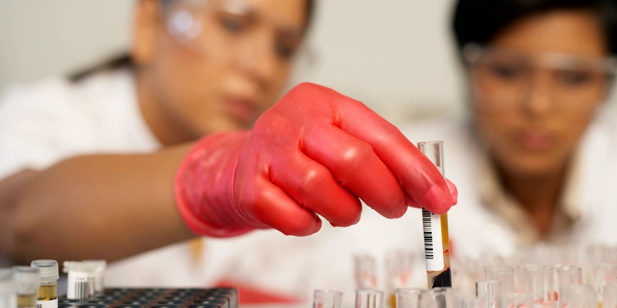 renal test | Irham medical center